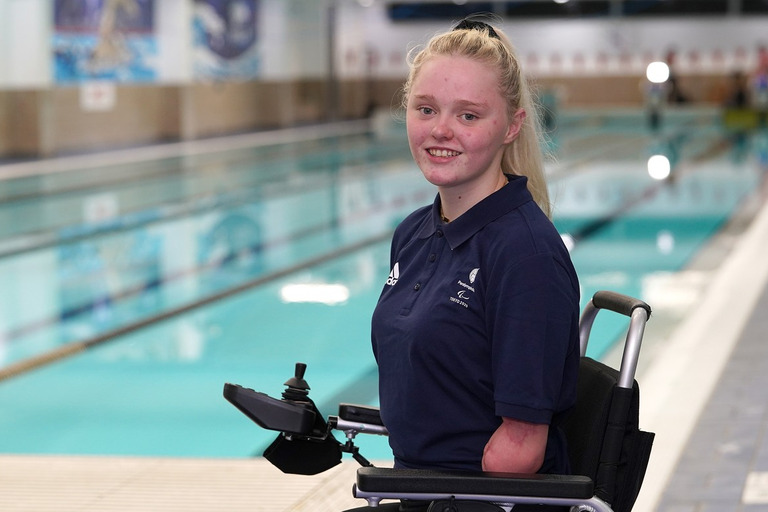 Ellie Challis: Bila je mrtva dvije minute, amputirane su joj obje noge ...