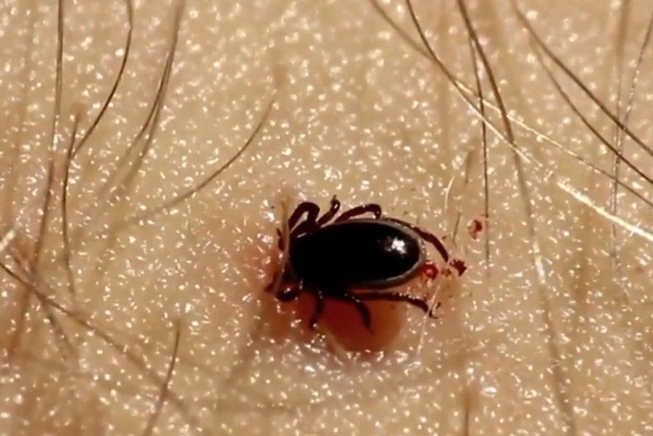 Počela sezona krpelja. Bolesti koje prenose nisu zezancija - Net.hr