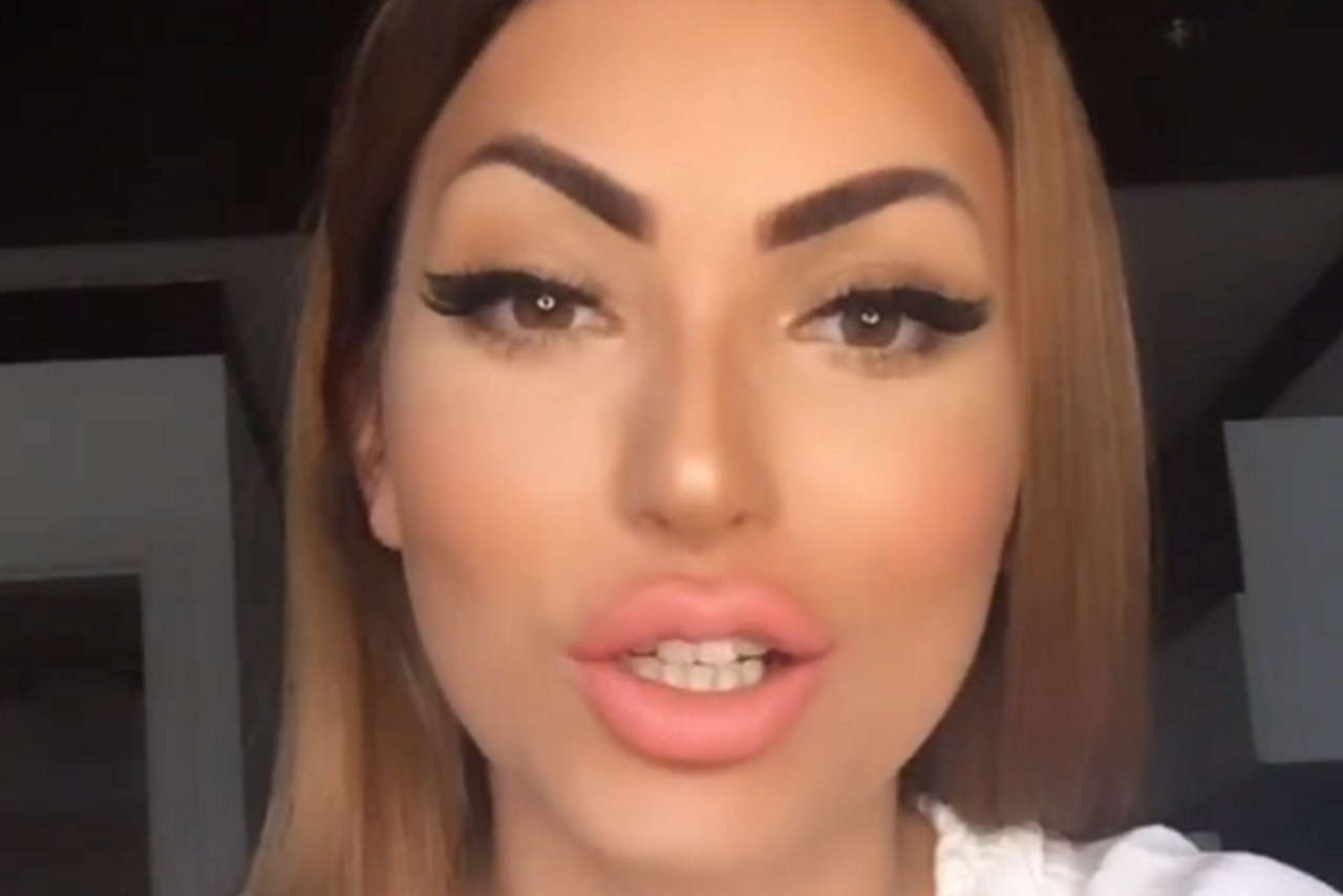 HANA RODIĆ I DALJE MARLJIVO RADI NA SVOM IZGLEDU: Nakon grudi i usana ...