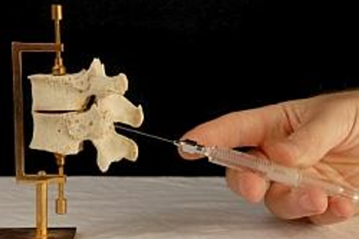 Treba li mi epiduralna anestezija? (II dio) - Žena.hr