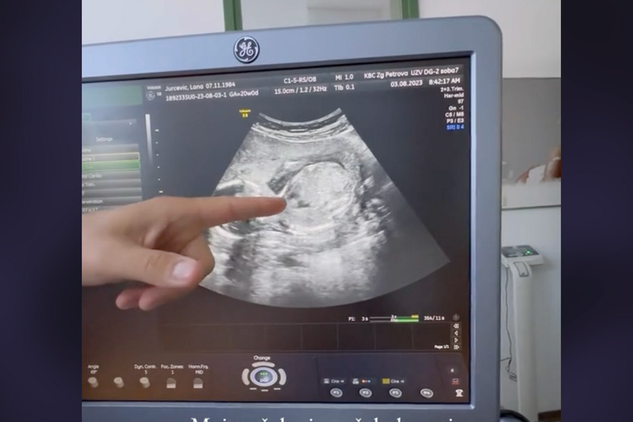 Trudna Lana Jurčević je podijelila snimku ultrazvuka i mnoge raznježila: 'Nakon naše male borbe ...