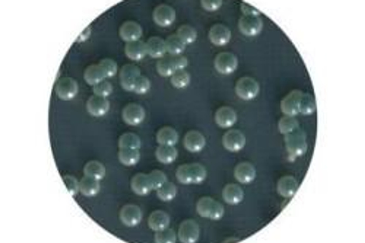 Kandidijaza (gljivične infekcije) - Žena.hr