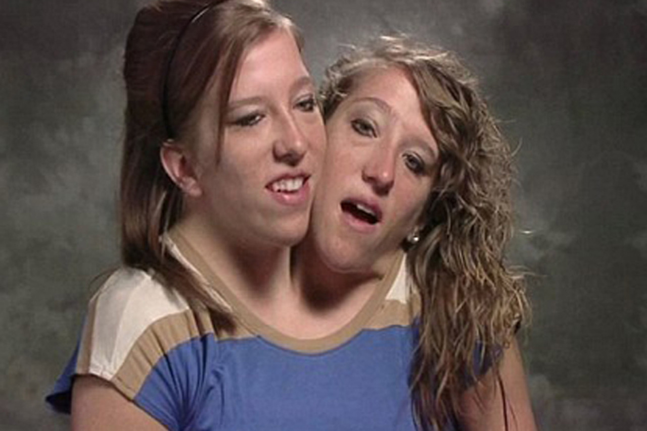 Ovo su najpopularnije blizanke na svijetu