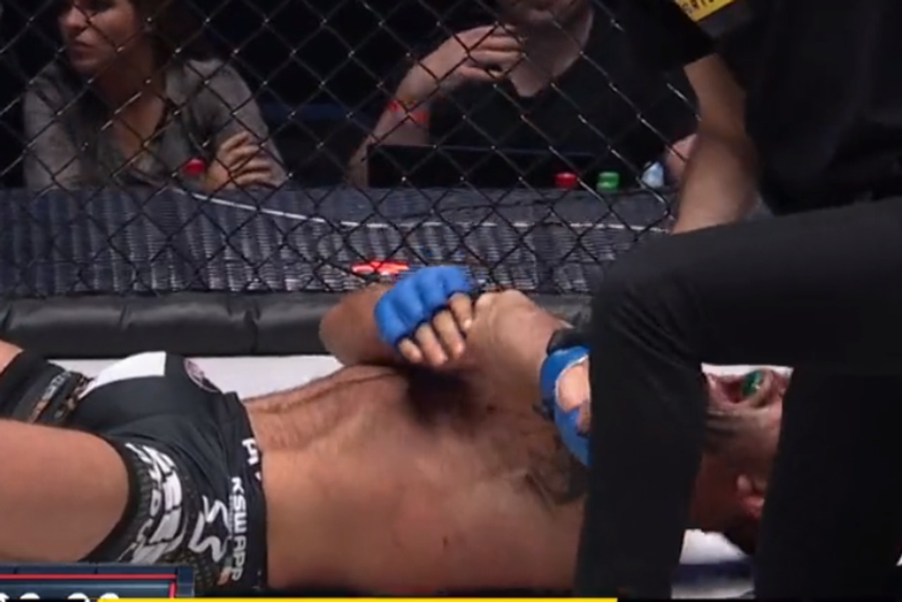 Uvjerljivo jedna od najgorih ozljeda u povijesti MMA-a. Pogledajte ...