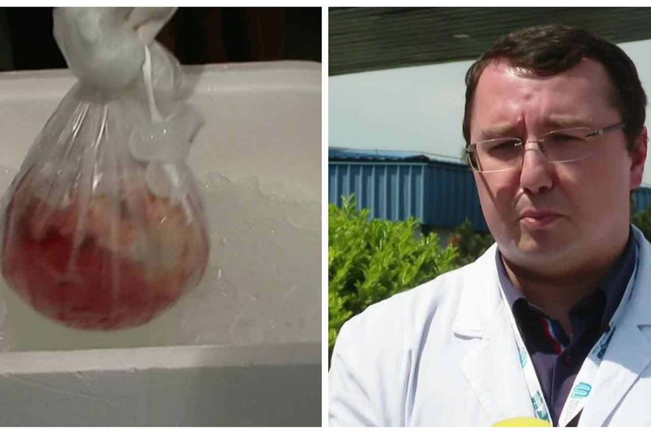 Otkrivamo detalje prve transplantacije srca od pojave korone: Organ je stigao iz Slovenije ...